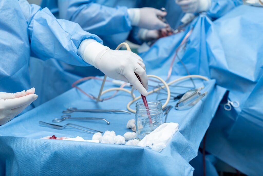 How Oral Cancer Surgery Impacts Speech and Eating – and How to Adapt ...